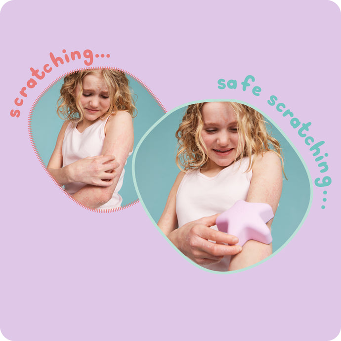 Scratch Star Case – Cosi Care ltd