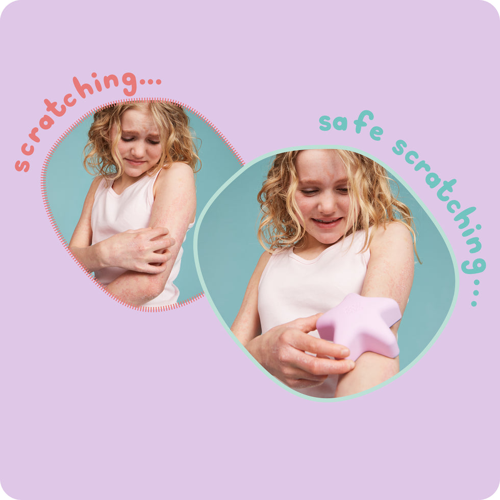 Scratch Star Case – Cosi Care ltd