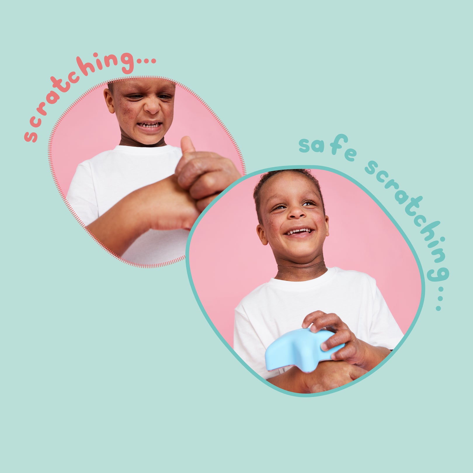 Cooling Scratch Star | Instant Itch Relief for itchy skin – Cosi Care ltd