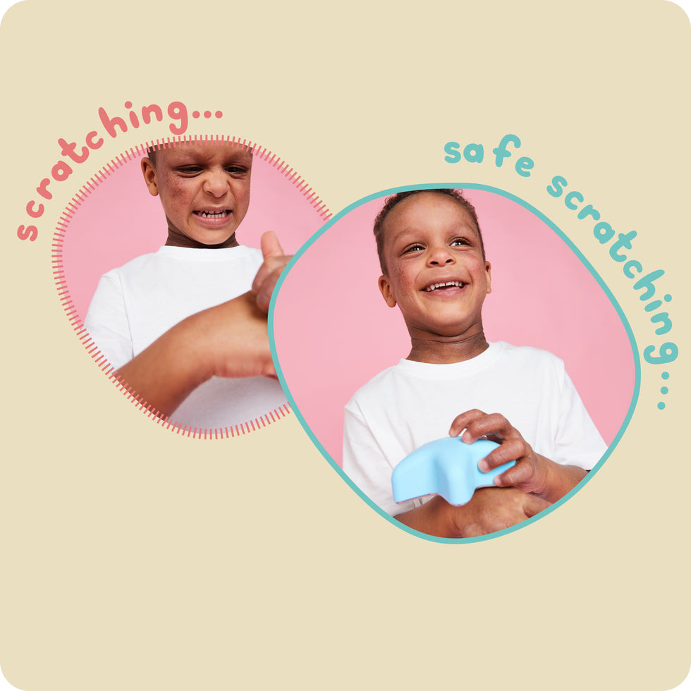 Scratch Star Case – Cosi Care ltd